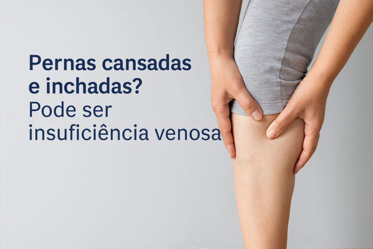 Pernas cansadas e inchadas? Pode ser insuficiência venosa - Tratamento ...